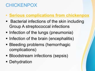 chickenpox & shingles.ppt