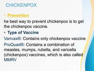 chickenpox & shingles.ppt