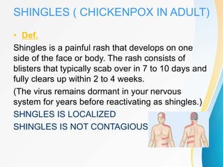 chickenpox & shingles.ppt