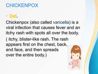 chickenpox & shingles.ppt