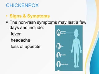 chickenpox & shingles.ppt