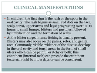 Chickenpox and smallpox | PPTX