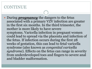 Chickenpox and smallpox | PPTX