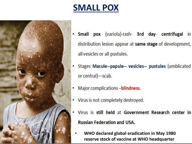 Chicken Pox & Small Pox.pptx