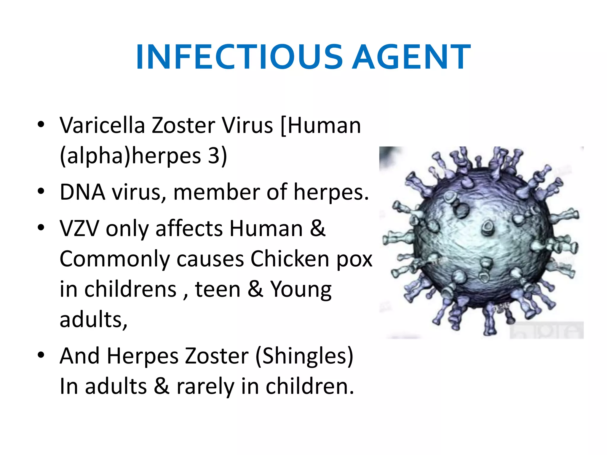 Chicken pox (varicella) | PPTX