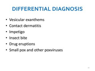 Chicken pox (varicella) | PPTX