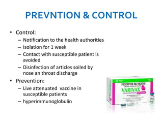 Chicken pox (varicella) | PPTX