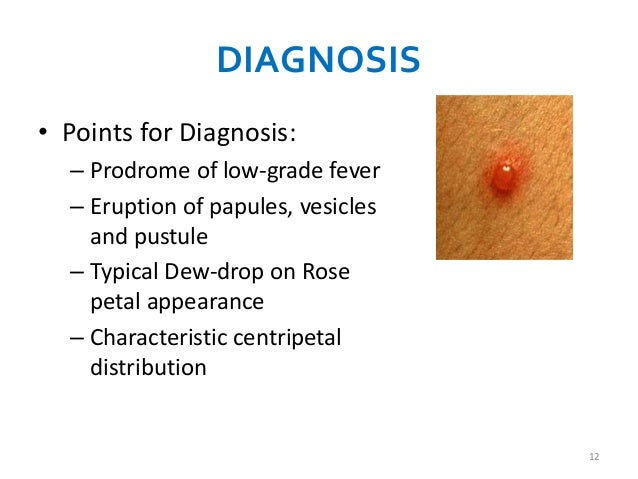Chicken pox (varicella)