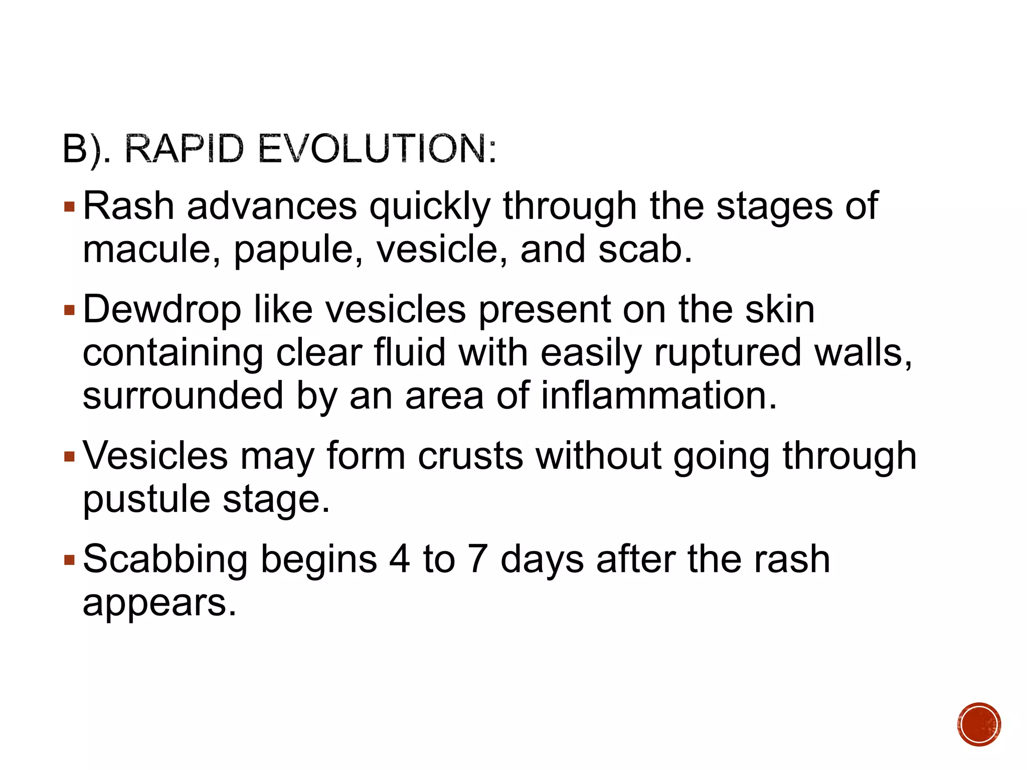CHICKENPOX (VARICELLA).pptx