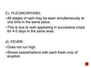 CHICKENPOX (VARICELLA).pptx