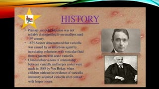 Chicken pox(varicella).pptx