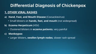 CHICKEN POX (VARICELLA).pptx varicella zoster | PPTX