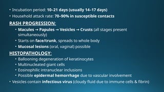CHICKEN POX (VARICELLA).pptx varicella zoster | PPTX