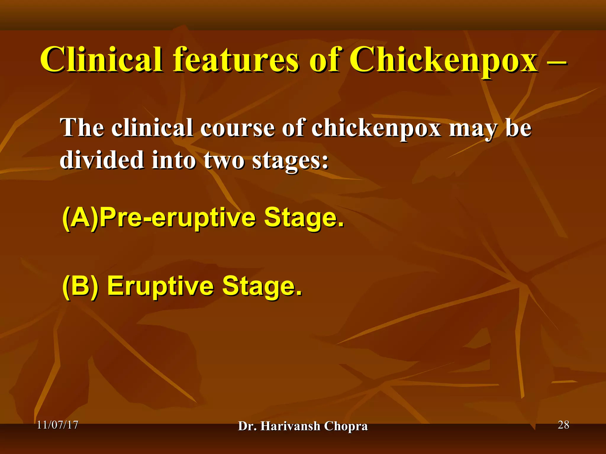 Chickenpox (varicella) dr harivansh chopra | PPT
