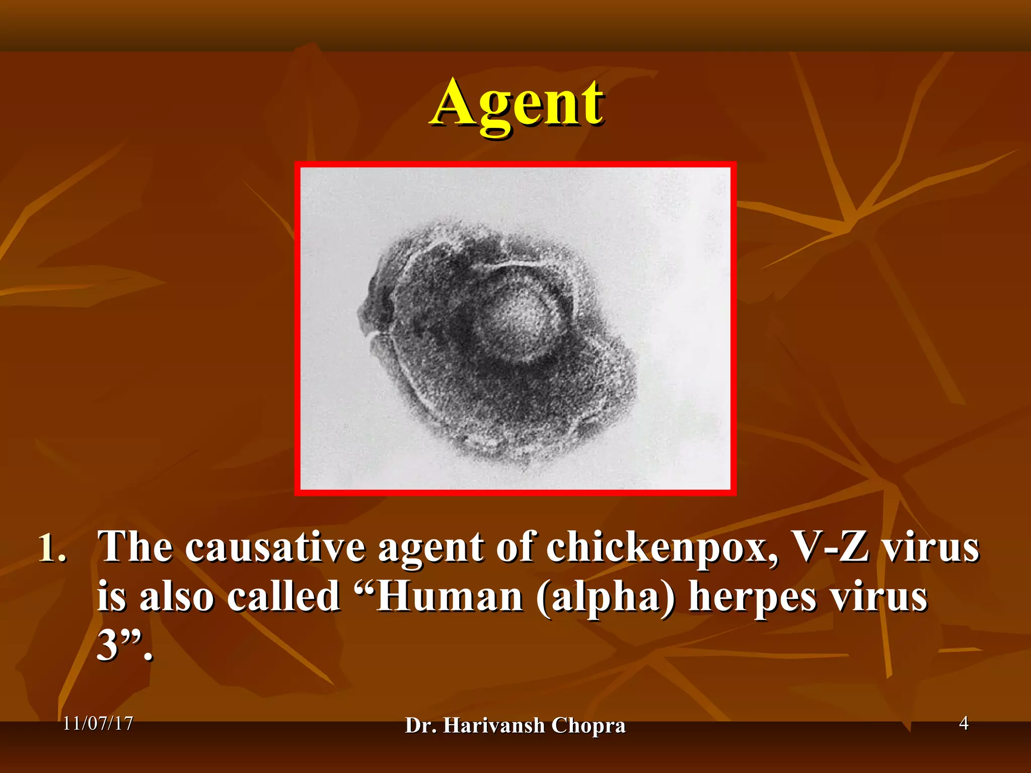 Chickenpox (varicella) dr harivansh chopra | PPT