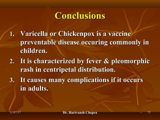 Chickenpox (varicella) dr harivansh chopra | PPT