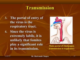 Chickenpox Transmission