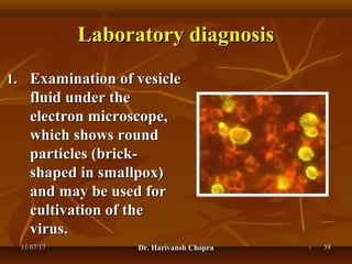 Chicken Pox Virus Under Microscope