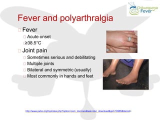 Chikungunya in Bangladesh | PPTX