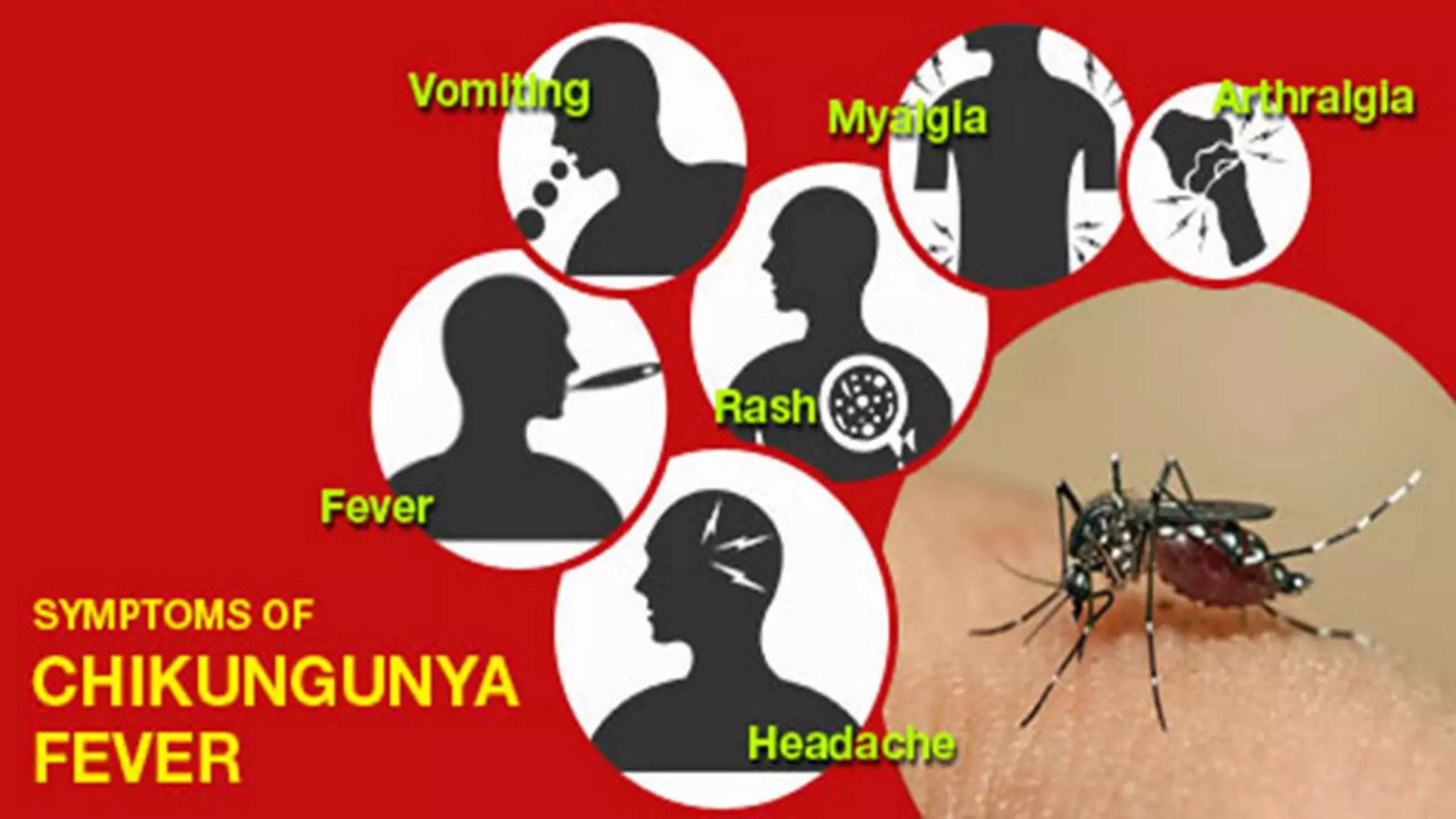 Chikungunya | PPTX