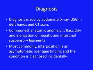 Chiladiti syndrome | PPTX