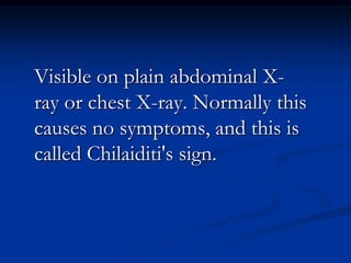 Chilaiditi's syndrome | PPTX