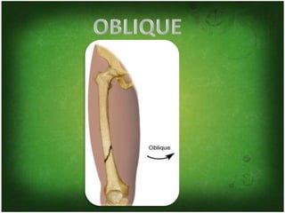 Child abuse and greenstick fracture .7man