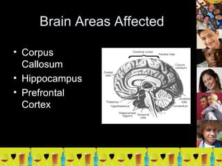 Alcohol and Adolescent Development | PPT