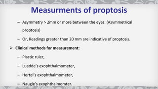 Child Proptosis | PPTX