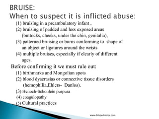 Child abuse | PPT