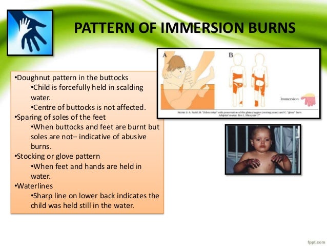 Child abuse and neglect
