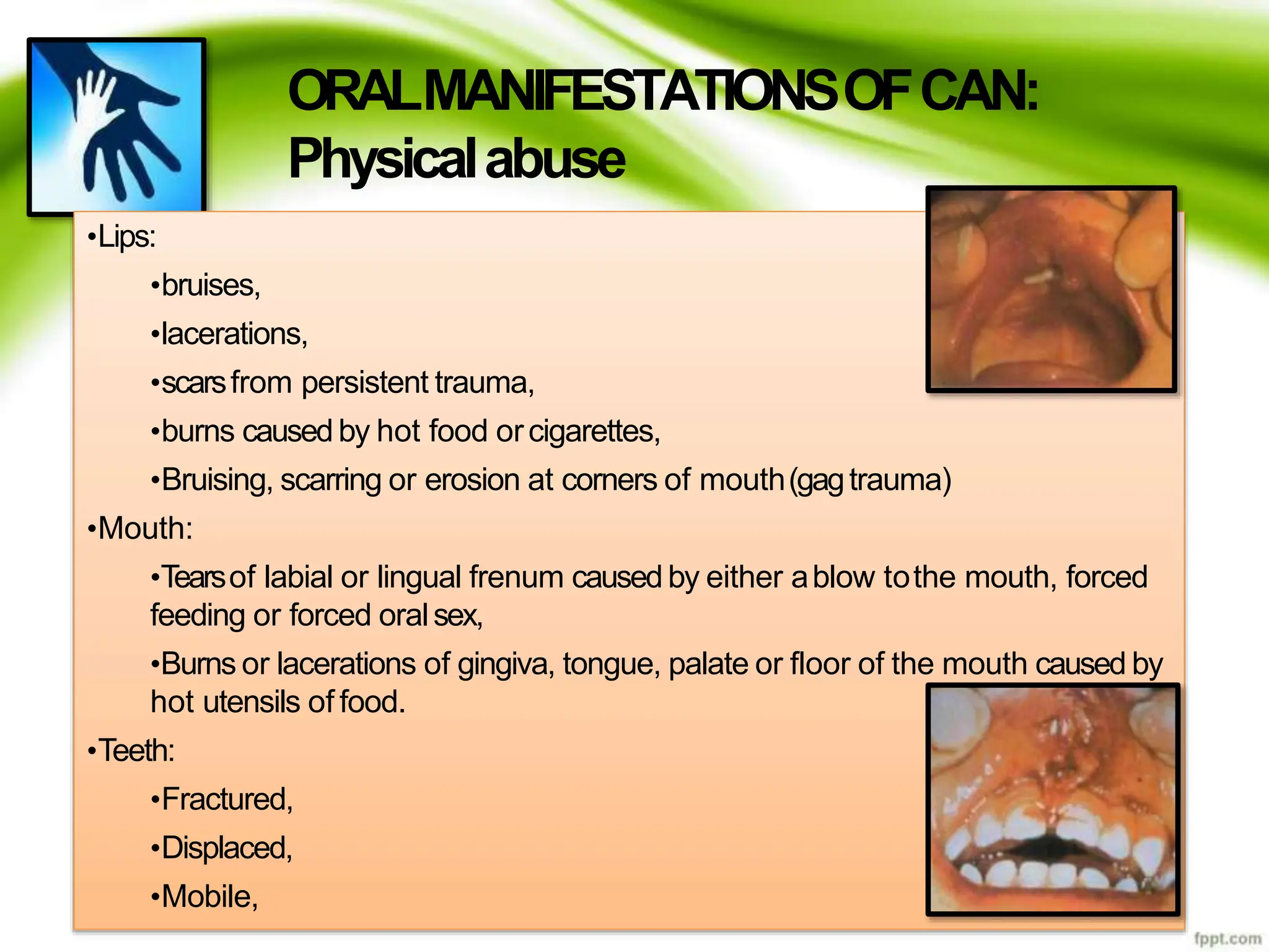 child abuse and neglect presentation new | PPTX