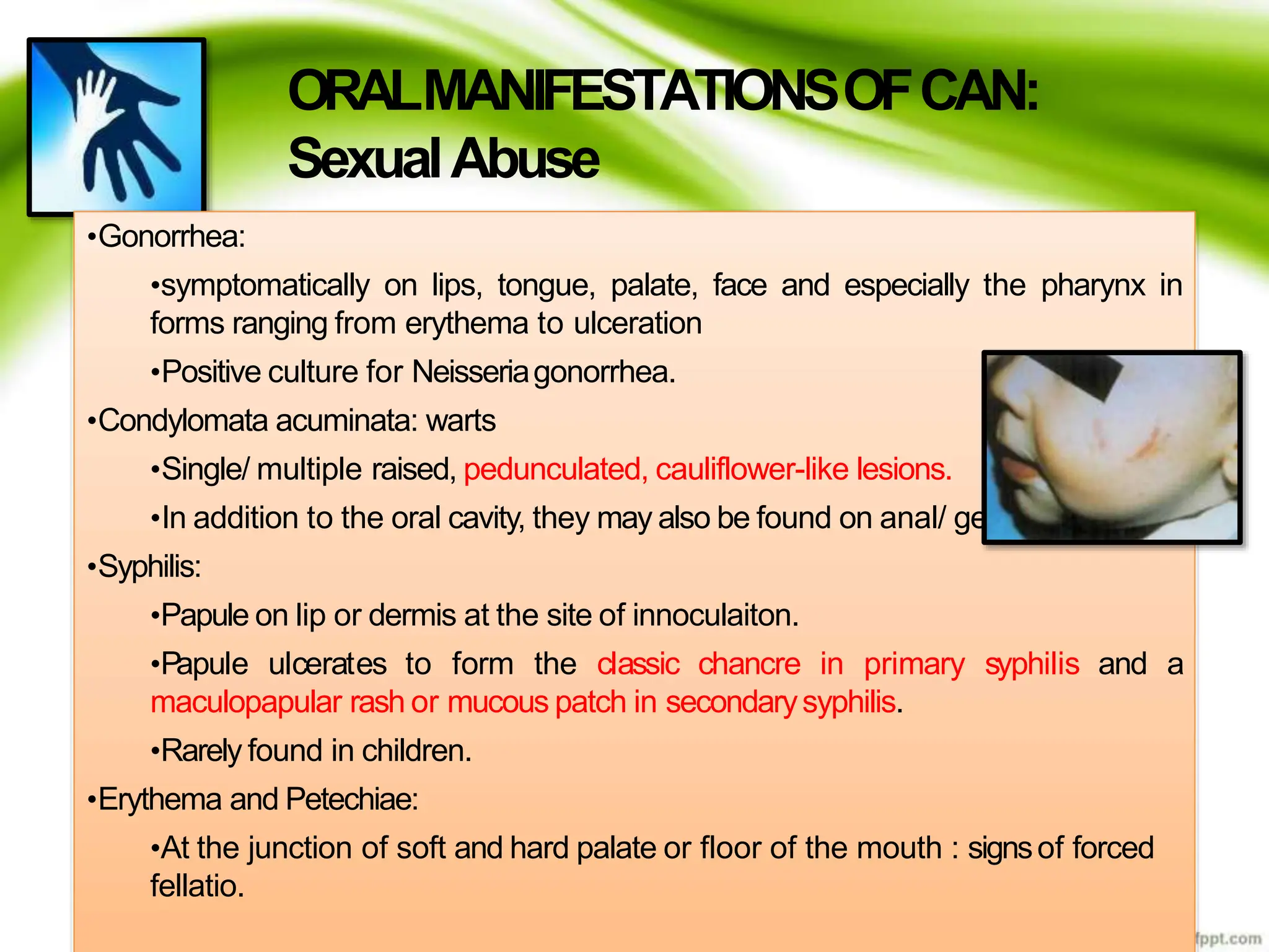 child abuse and neglect presentation new | PPTX