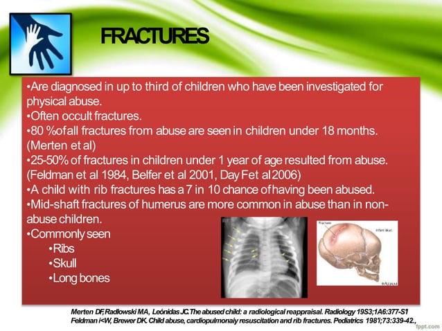 child abuse and neglect presentation new | PPTX