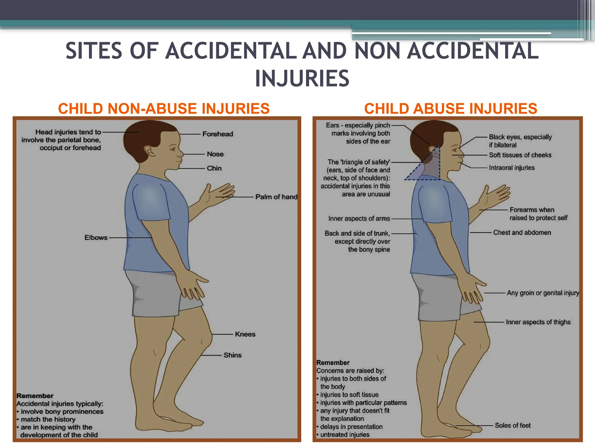 child abuse empowerment Bsc 4th yr ppt.pptx