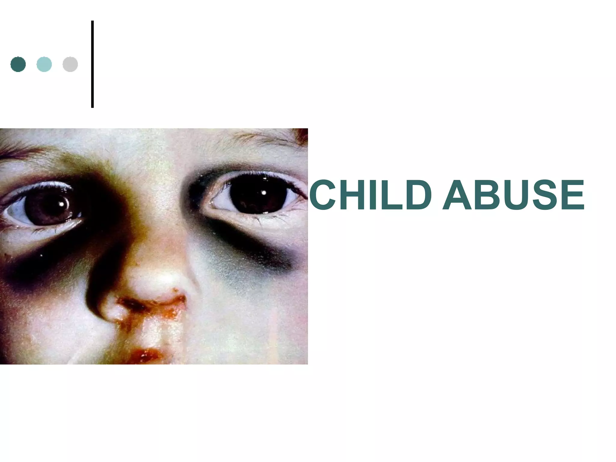 child abuse ppt.pptx