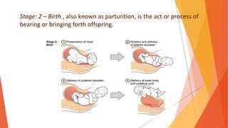 Childbirth - a process