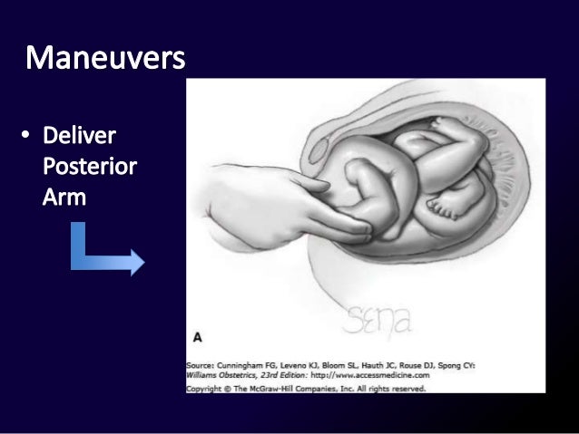 Childbirth emergencies (2)