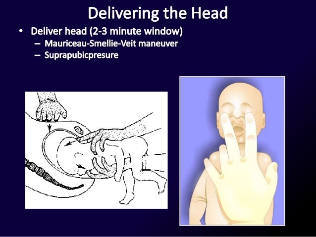 Childbirth emergencies (2)