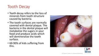 Child dentistry- Dental Care for Children | PPTX