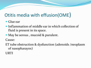 otitis media | PPTX