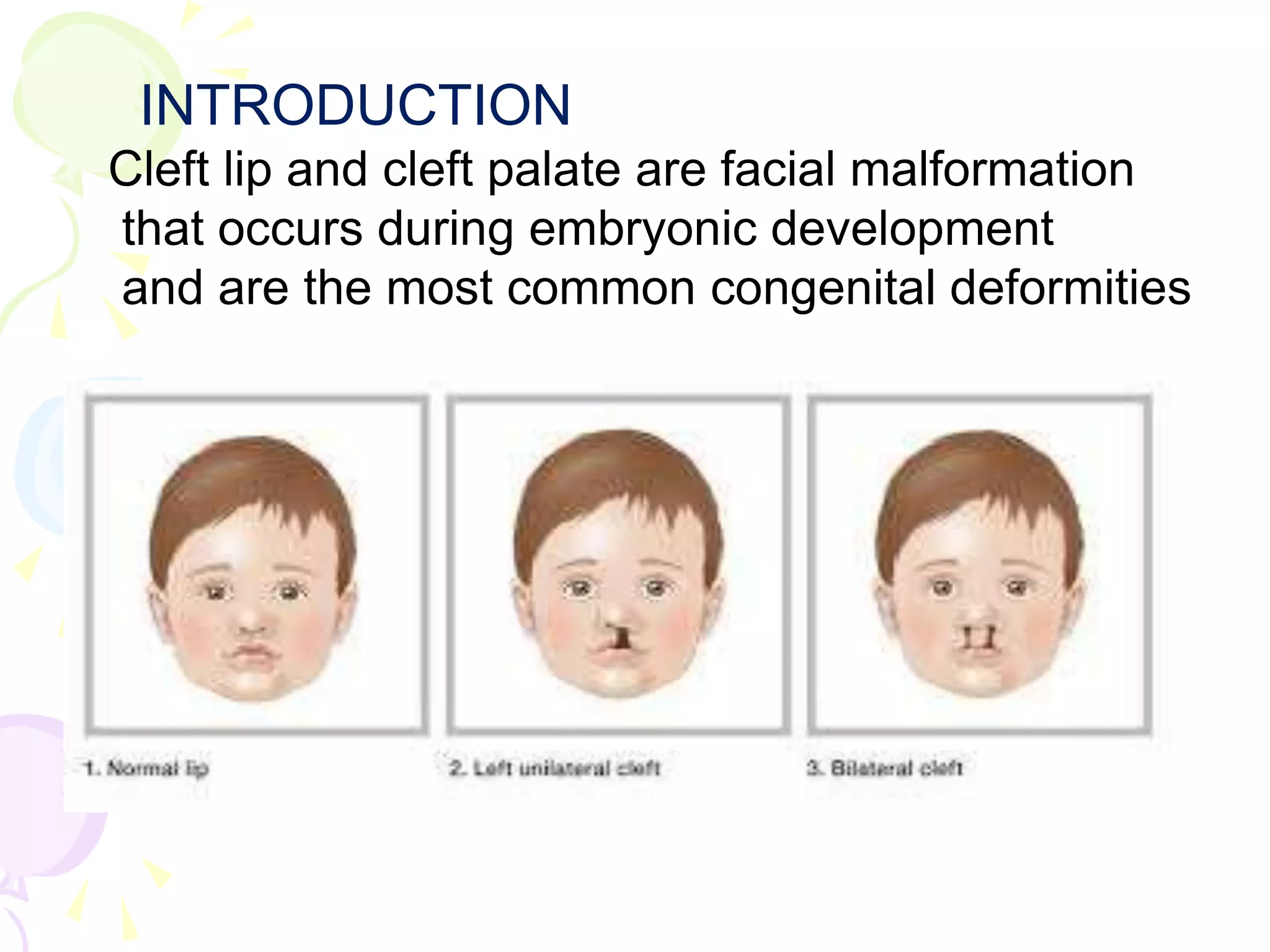 Tracheo Esophahgeal Fistula,Cleft lip and Palate | PPTX