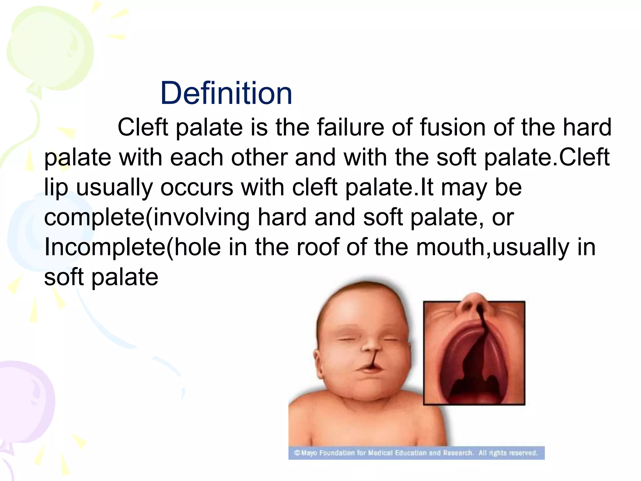 Tracheo Esophahgeal Fistula,Cleft lip and Palate | PPTX