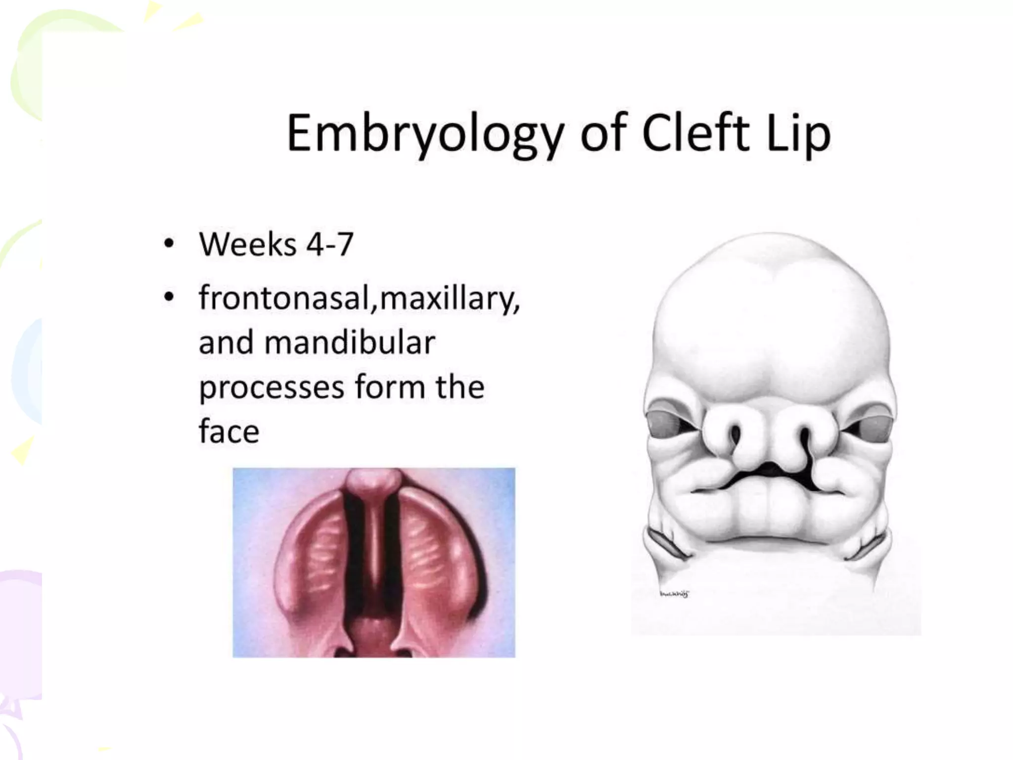 Tracheo Esophahgeal Fistula,Cleft lip and Palate | PPTX