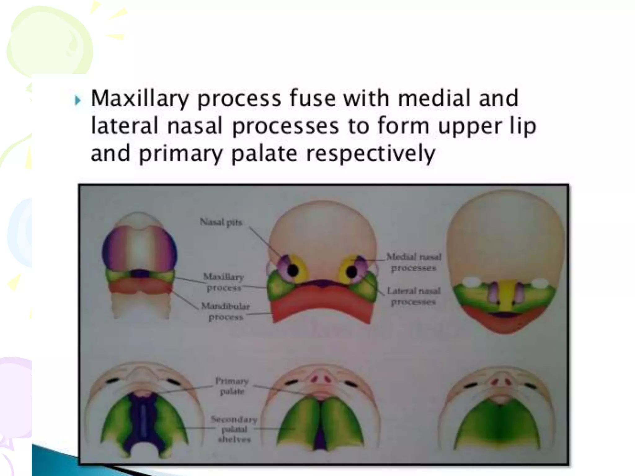 Tracheo Esophahgeal Fistula,Cleft lip and Palate | PPTX