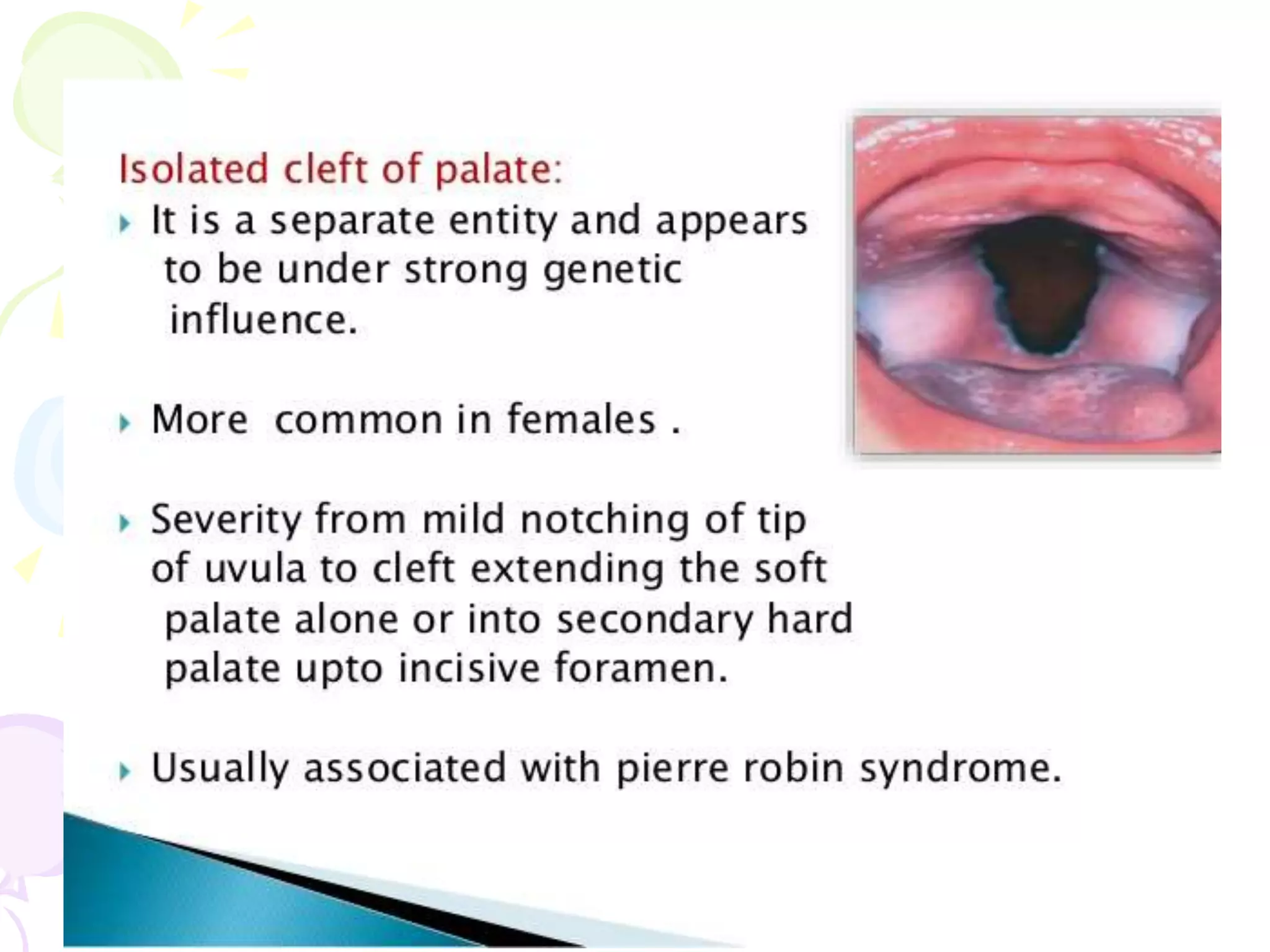 Tracheo Esophahgeal Fistula,Cleft lip and Palate | PPTX