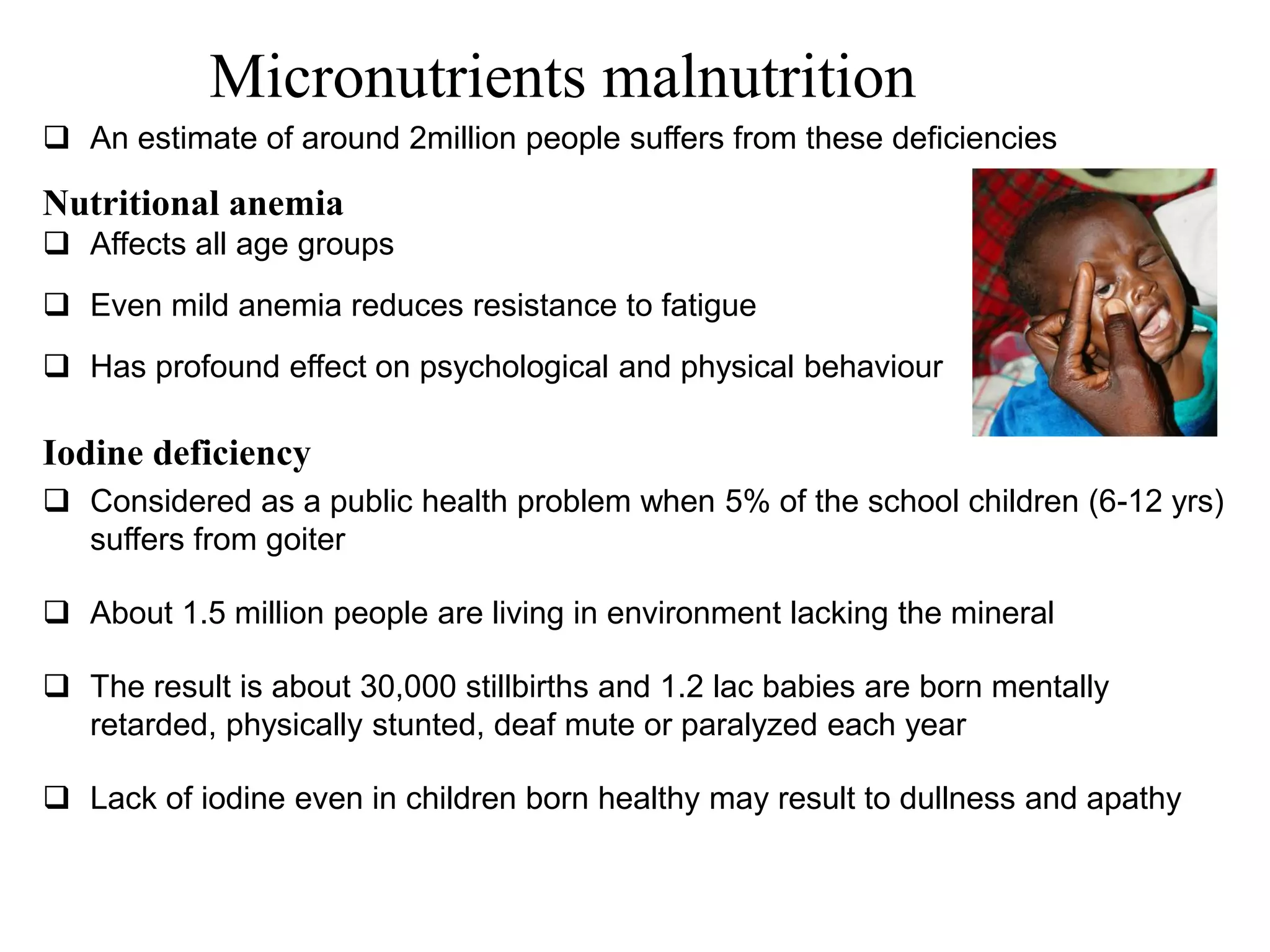 Child health problems | PPTX