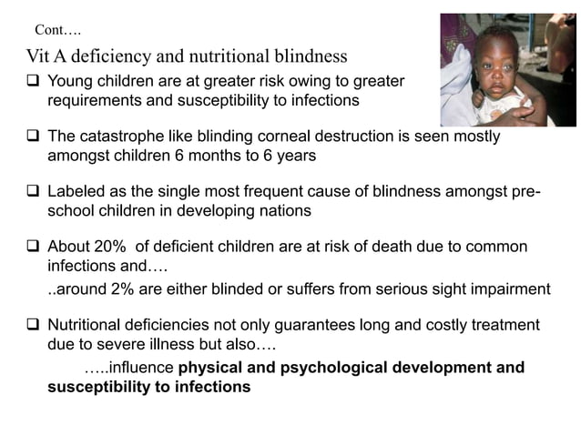 Child health problems | PPTX | Infectious Diseases | Diseases and ...