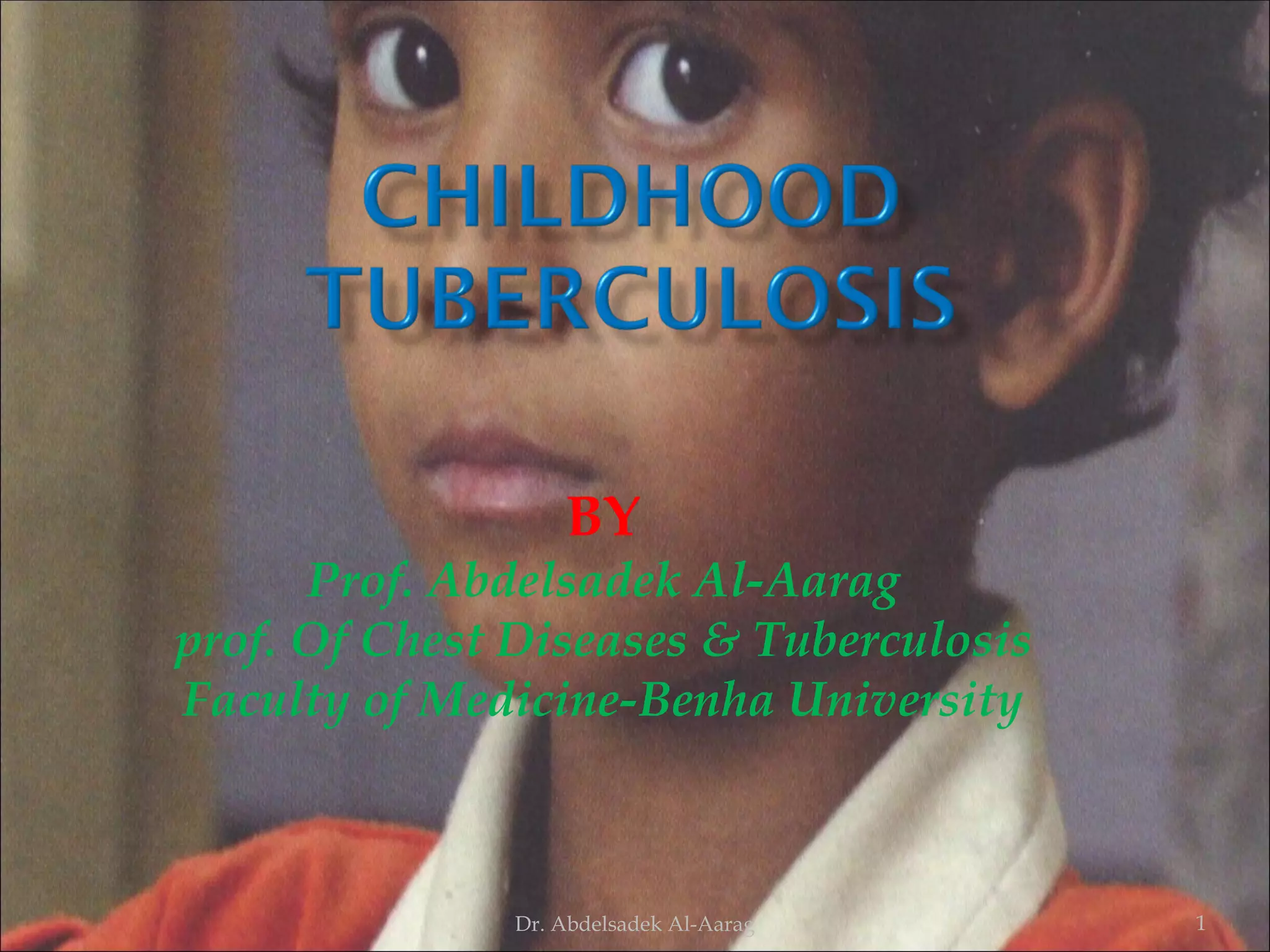 Childhood Tuberculosis | PPT