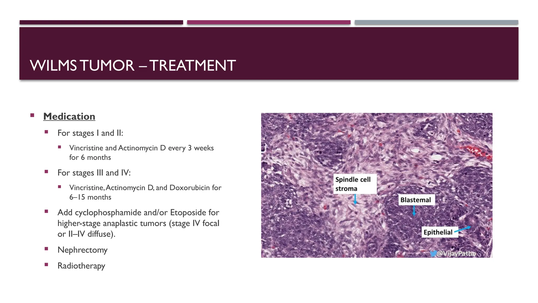 childhood-tumors-powerpoint-pedias-.pptx